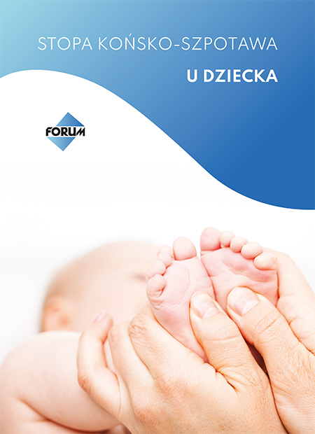 Stopa końsko-szpotawa u dziecka - Fizmedio