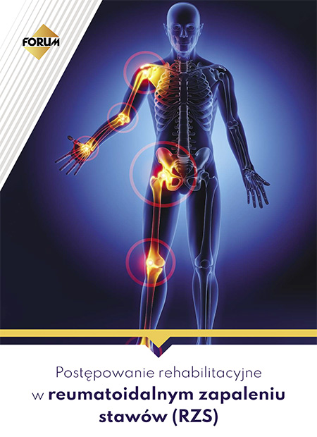 Postępowanie rehabilitacyjne w reumatoidalnym zapaleniu stawów (RZS ...